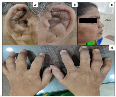 Spot the diagnosis – IRA eNewsLetter